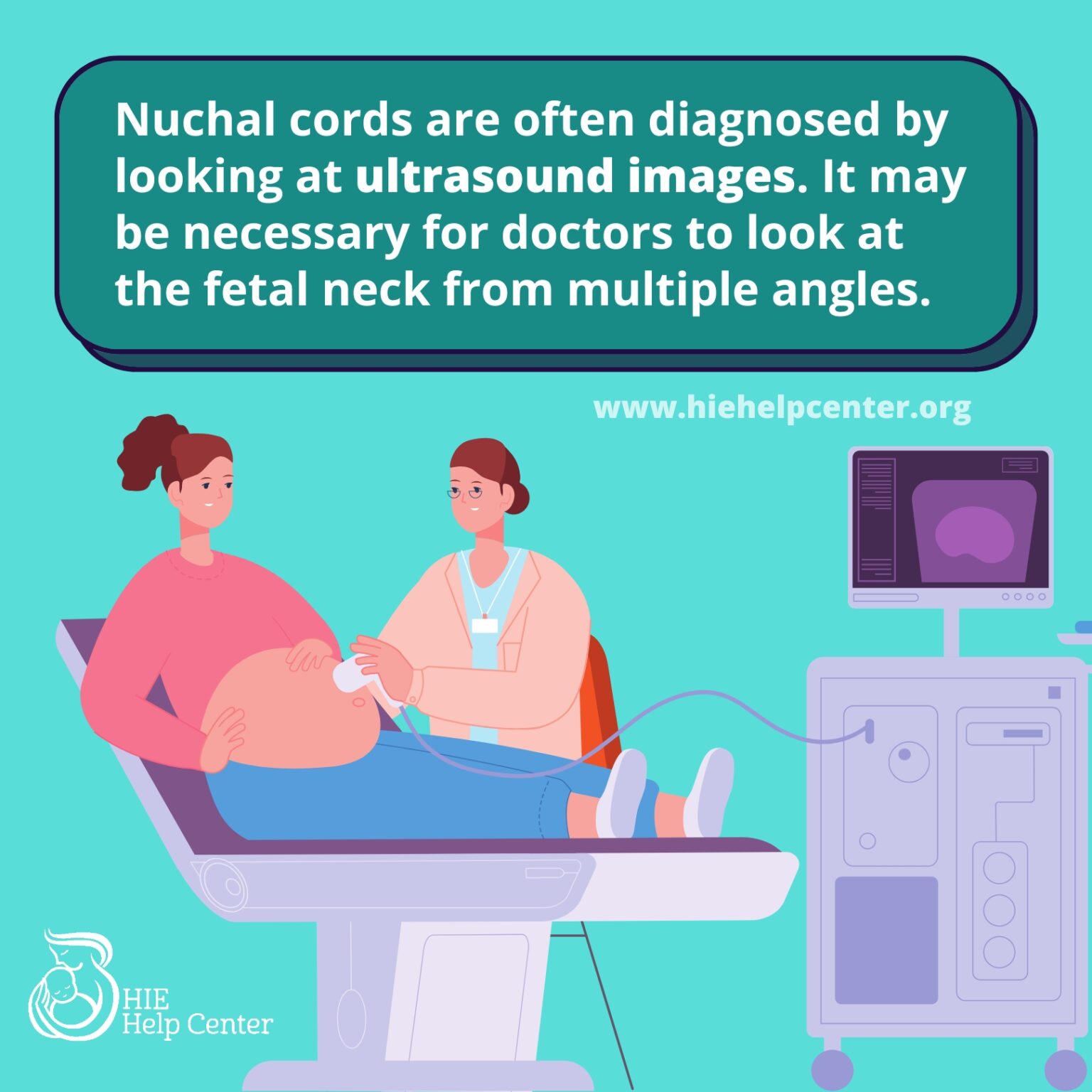 10 Things To Know About Nuchal Cords Hie Help Center