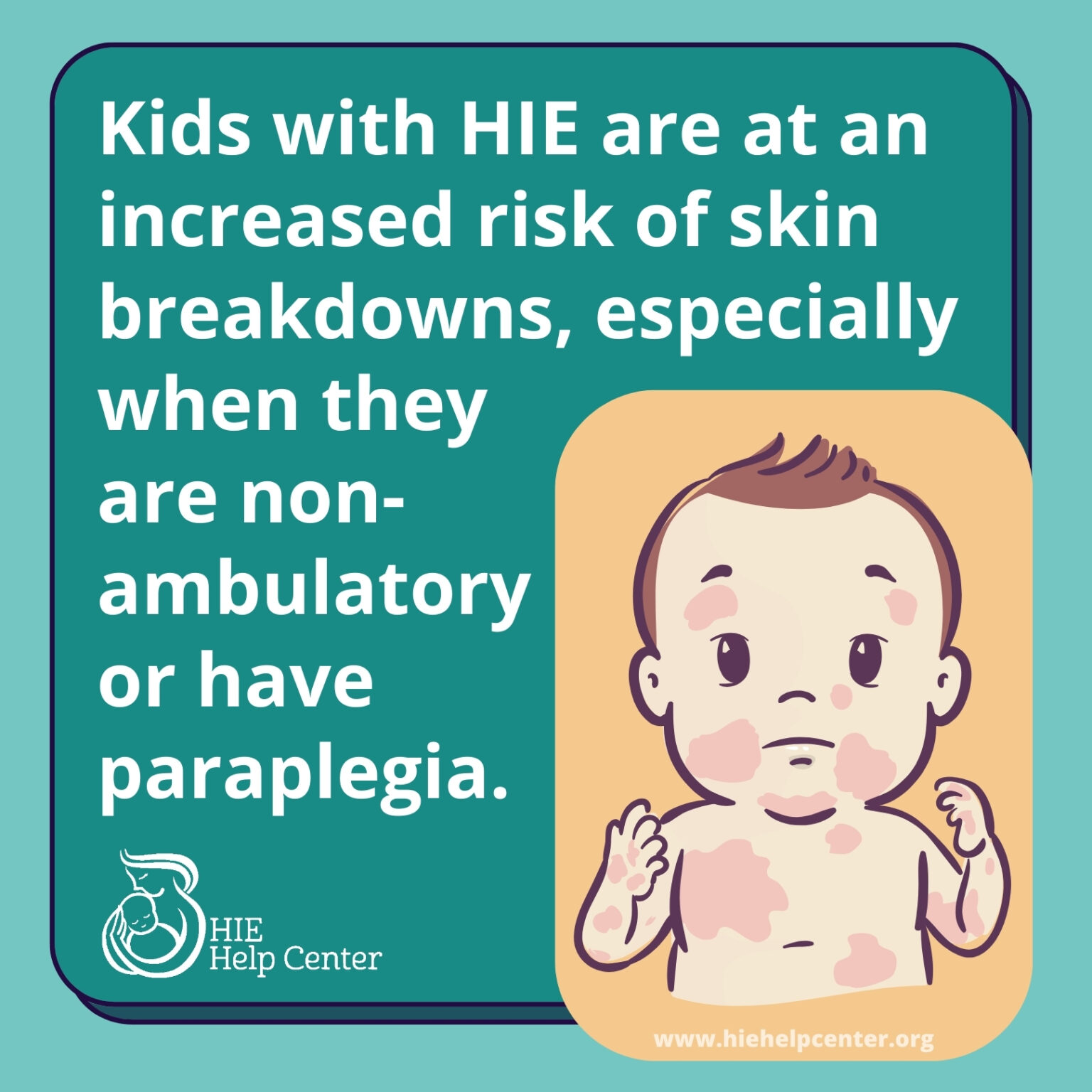 Skin Health & Hypoxic-Ischemic Encephalopathy | HIE Help Center