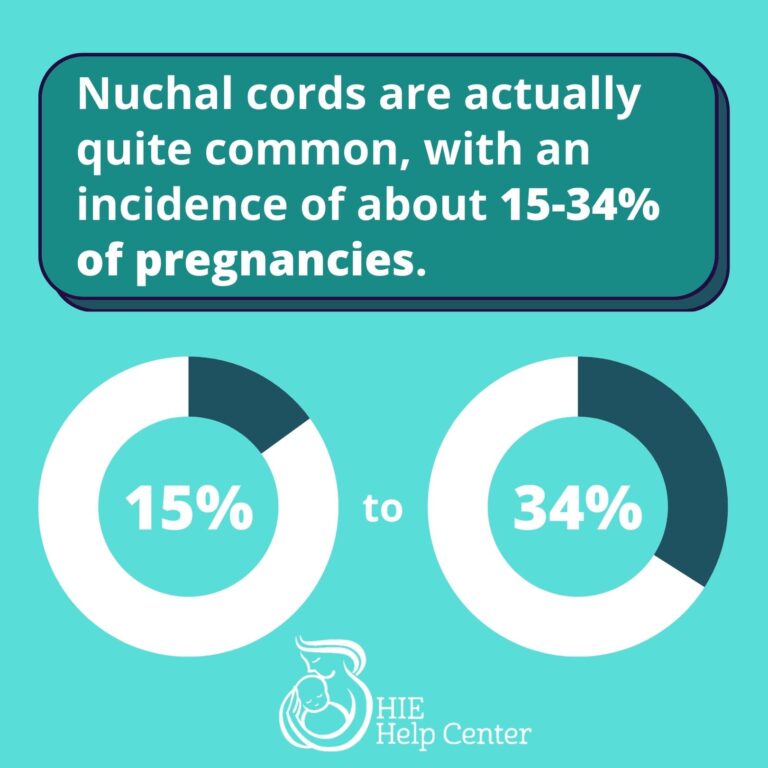 10 Things to Know About Nuchal Cords | HIE Help Center