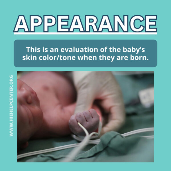 What is the Apgar Score? | The HIE Help Center