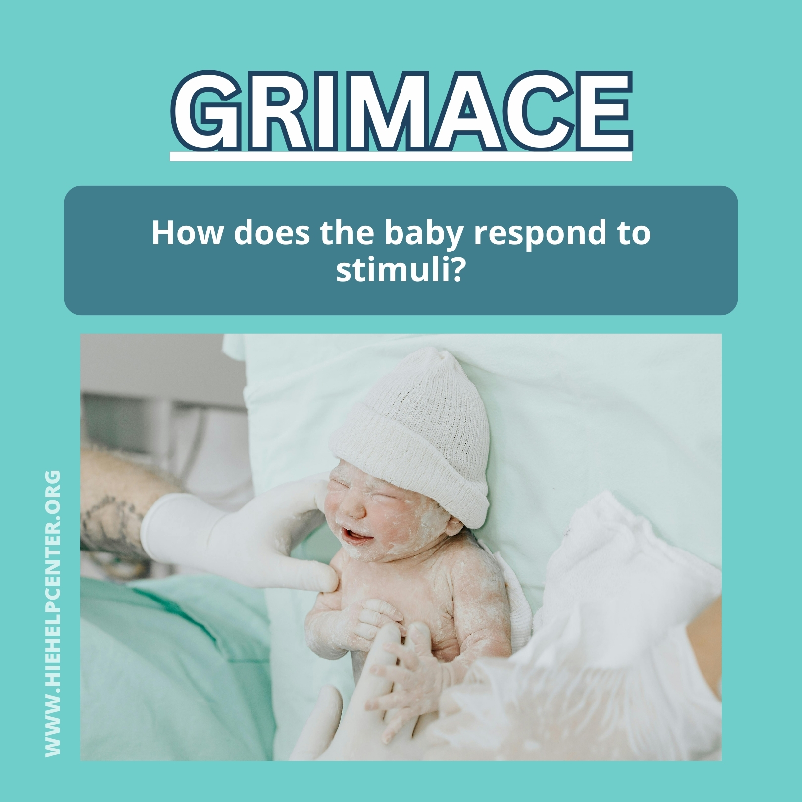 What is the Apgar Score? | The HIE Help Center