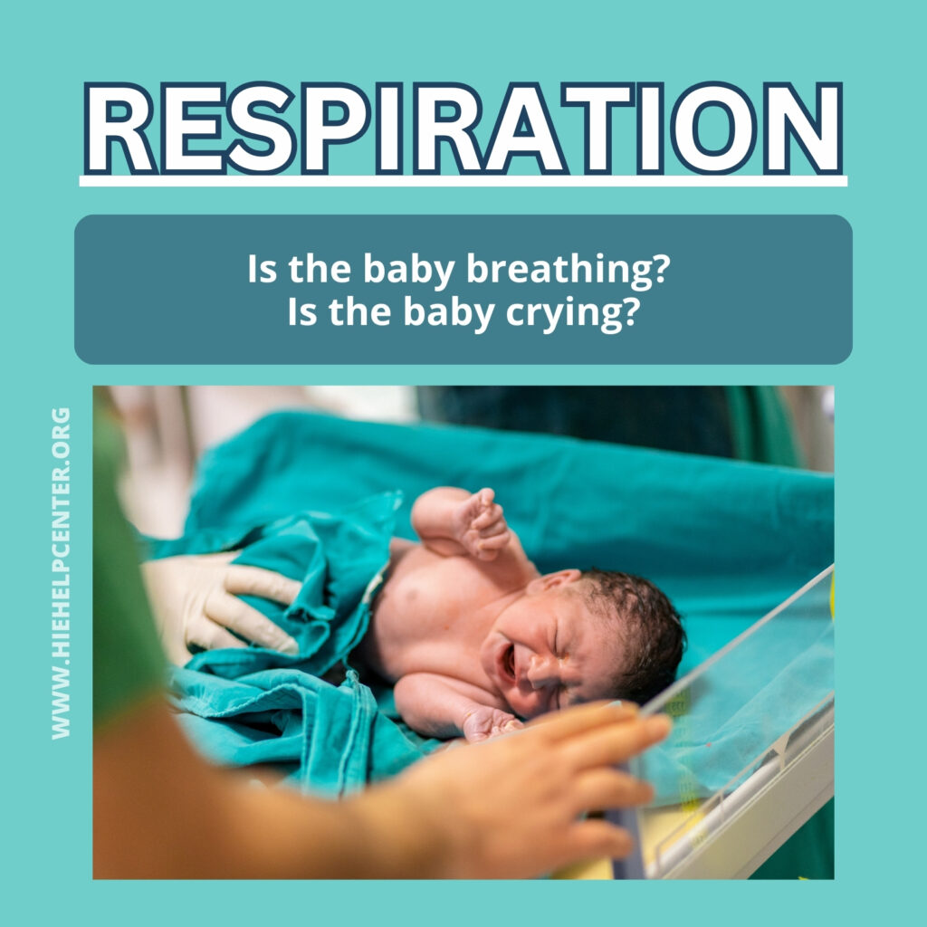 What is the Apgar Score? | The HIE Help Center